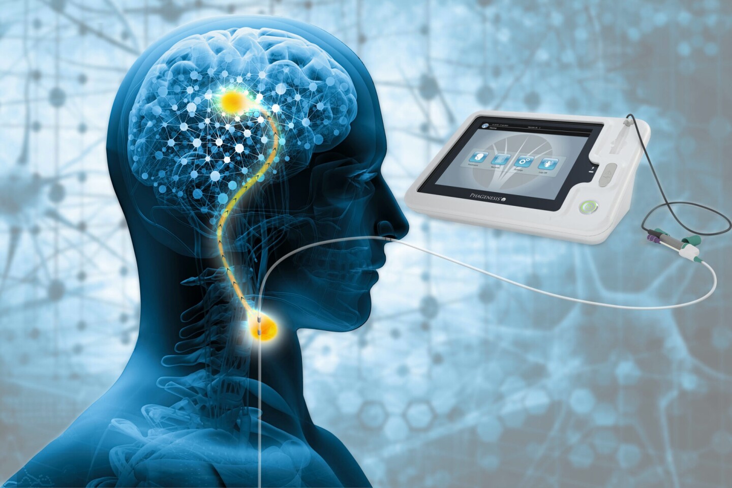 Electrical Stimulation and Dysphagia - MedSpeech Inc